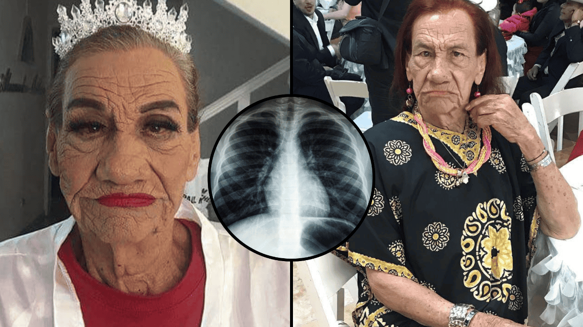 ¿De qué murió "La Gilbertona"? ¡Esto es lo que se sabe! | DIVERSO Salud